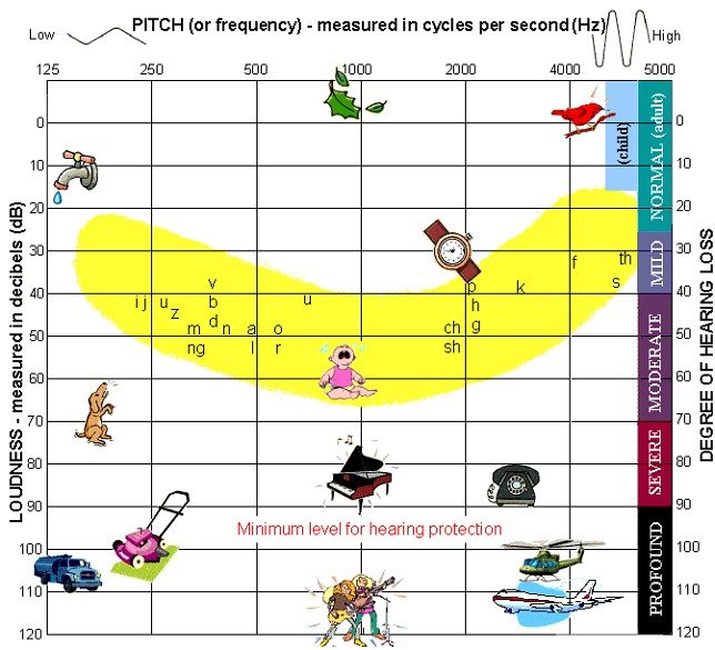 Hearing Loss - Understanding the Audiogram Hearing Loss - Understanding the Audiogram